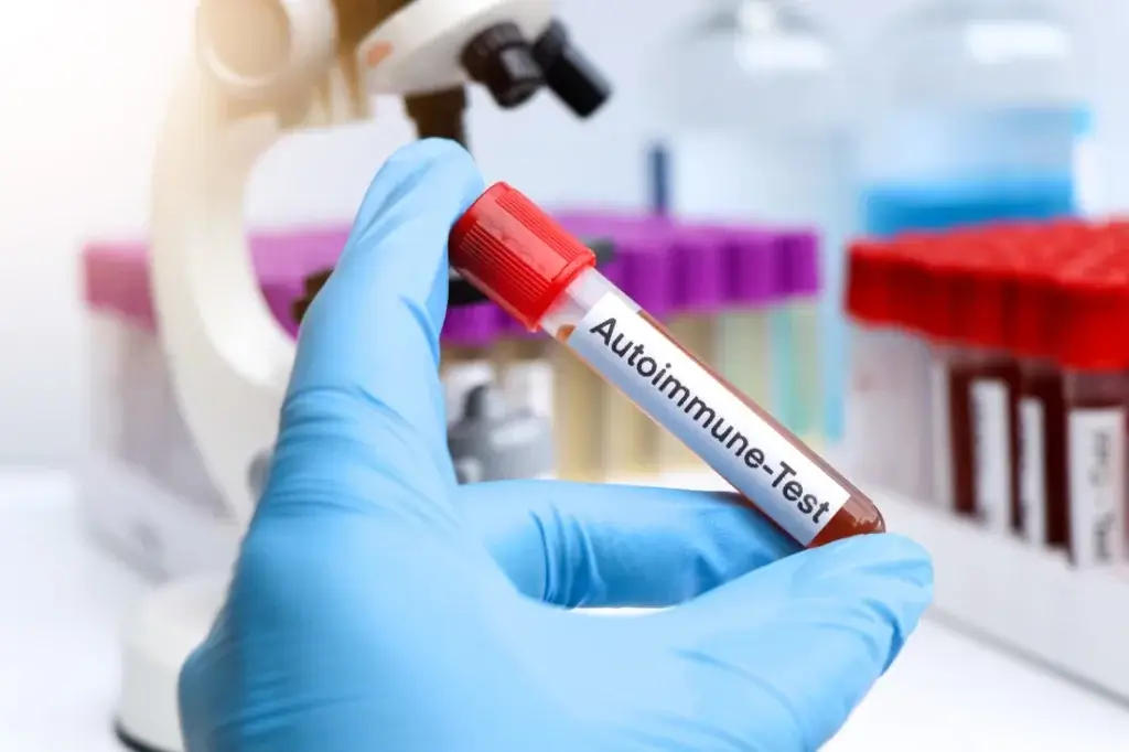 Can I Get Social Security Disability for Autoimmune Disorders?